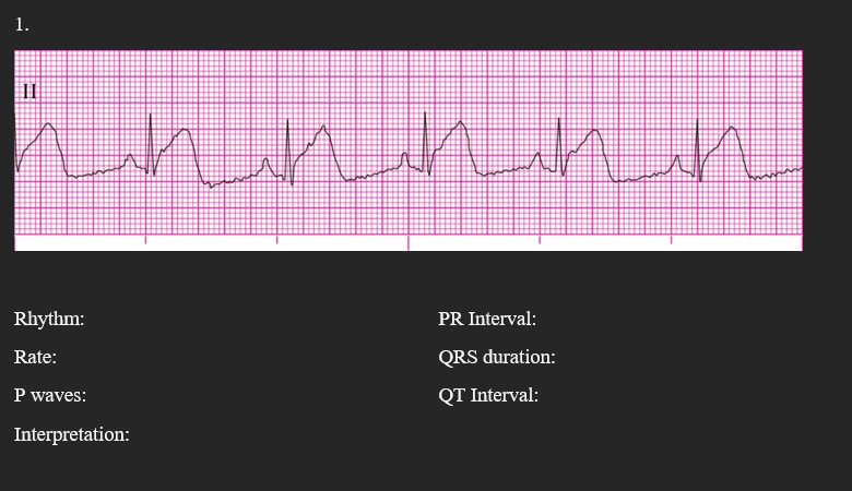 Solved 1. II nnnnnn Rhythm: Rate: PR Interval: QRS duration: | Chegg.com