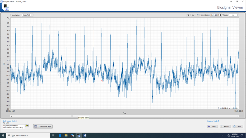 Solved Procedure National Instruments myDAQ is an relatively | Chegg.com