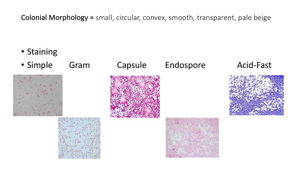 Alcaligenes Faecalis Gram Stain