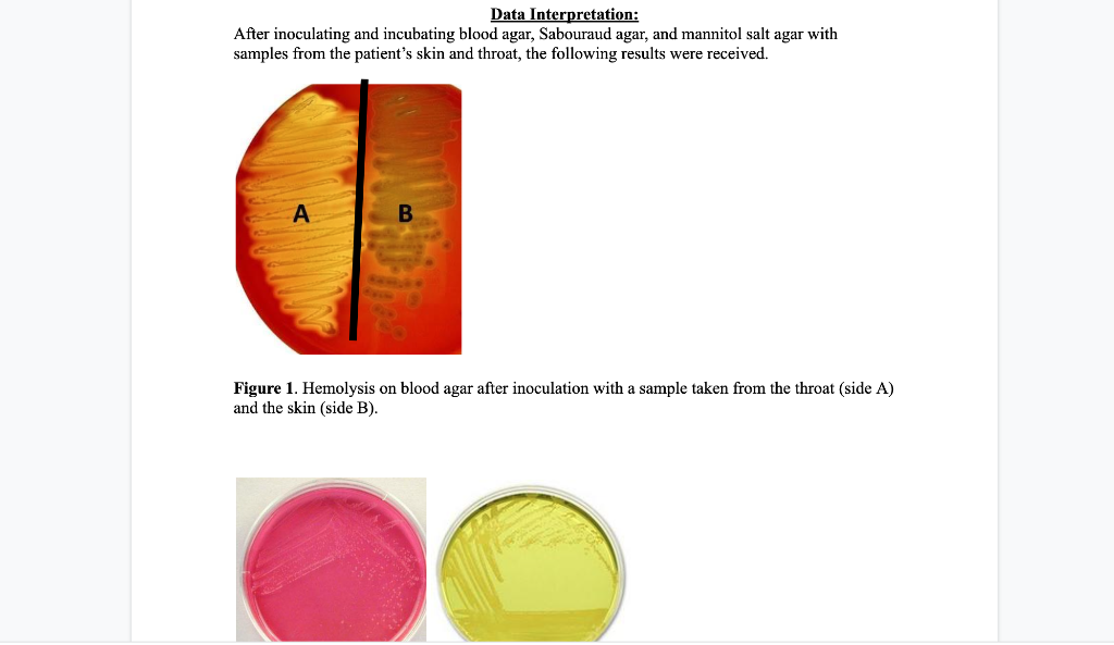 Solved Data Interpretation: After inoculating and incubating | Chegg.com