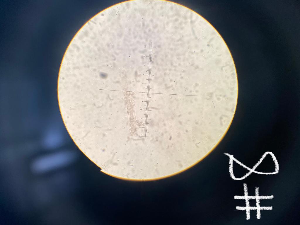 Solved Fecal Smear, unspecified stain (possibly Chlorazol | Chegg.com