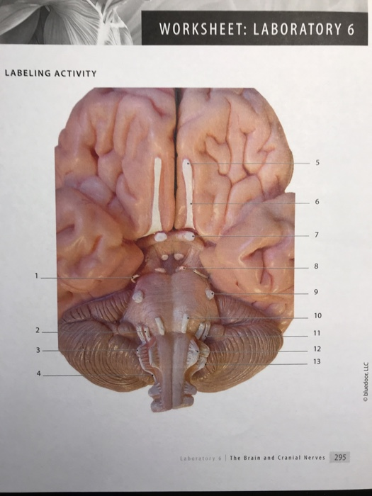 Solved WORKSHEET: LABORATORY 6 LABELING ACTIVITY -10 12 13 | Chegg.com