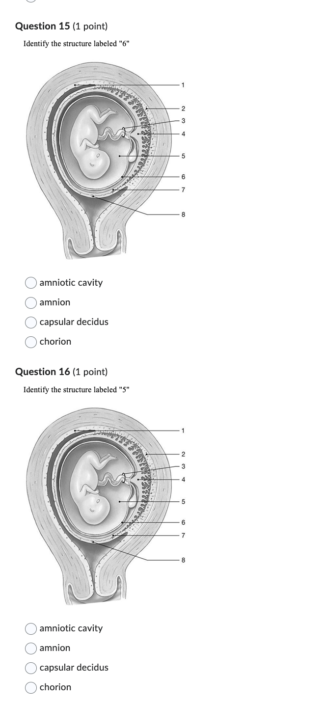 Solved Question 15 1 Point Identify The Structure Labeled