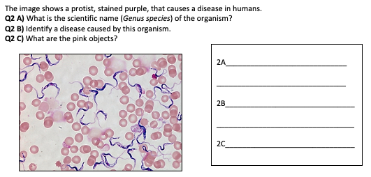 Solved The image shows a protist, stained purple, that | Chegg.com