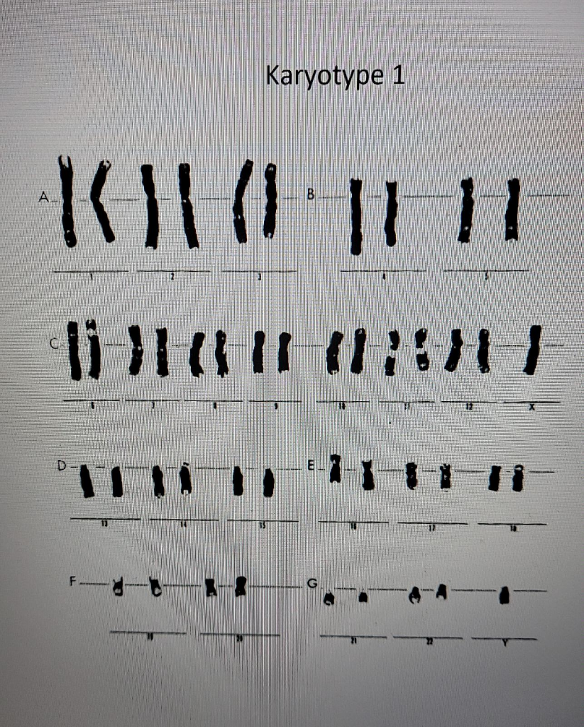 Solved Eqoys Table 9.2 Examples of Human Diseases Detectable | Chegg.com