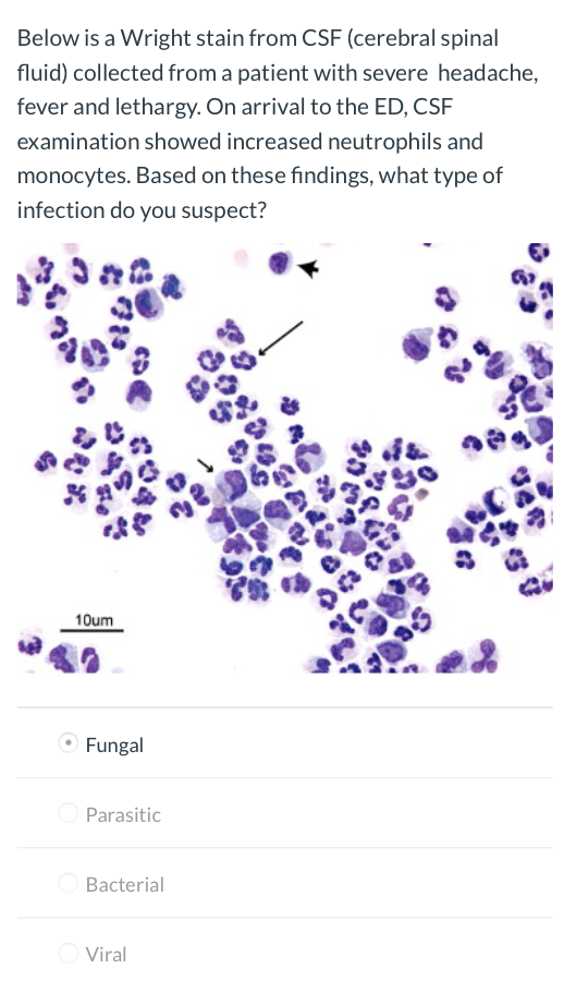 Solved Below is a Wright stain from CSF (cerebral spinal | Chegg.com
