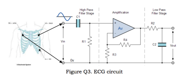 Solved Electronics : ECG Sensor CircuitA vital signs monitor | Chegg.com