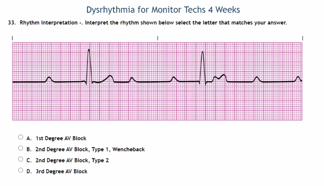Solved Dysrhythmia for Monitor Techs 4 Weeks 33. Rhythm | Chegg.com