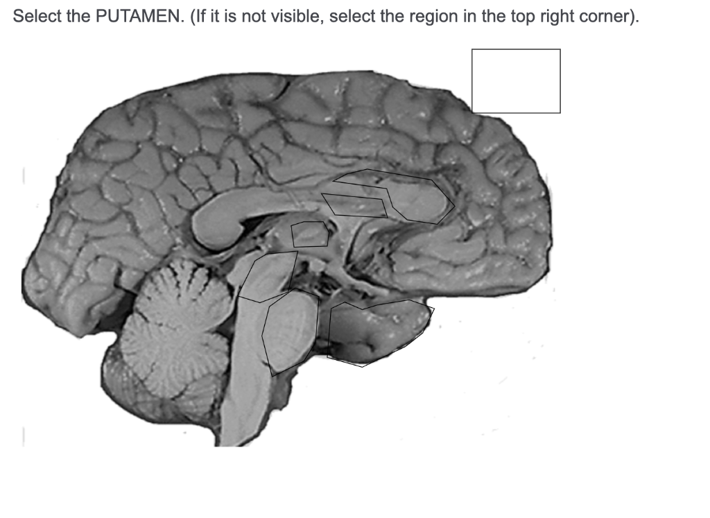 Solved Select the PUTAMEN. (If it is not visible, select the | Chegg.com