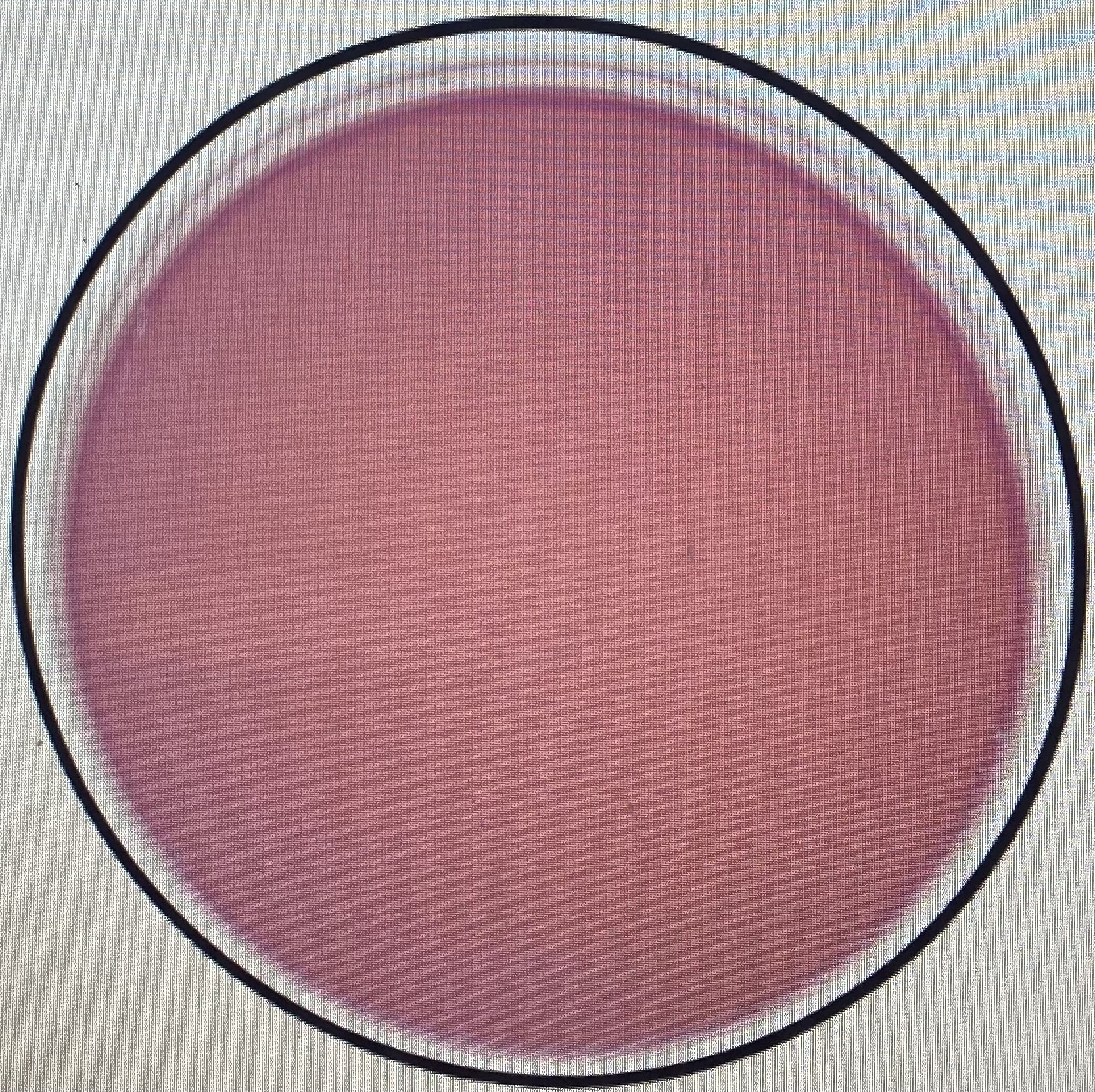 Solved Question 1- An unknown bacterium was inoculated into | Chegg.com