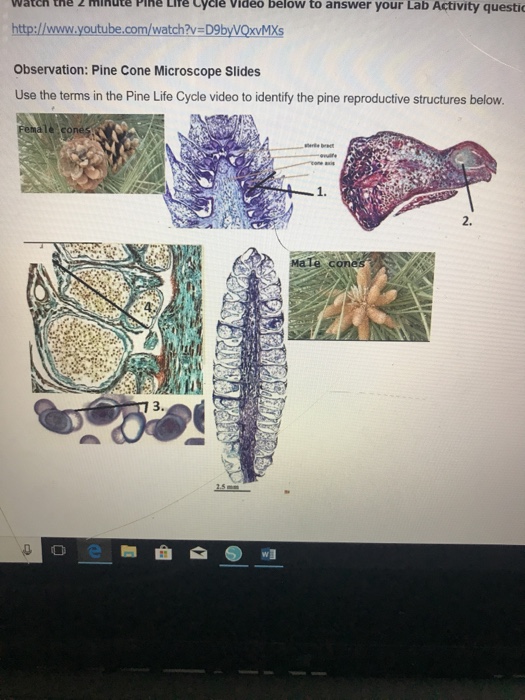 Female Pine Cone Microscope