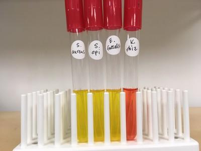 Solved Microbe PR Citrate MR VP DNase Urea Nitrate Gelatin | Chegg.com