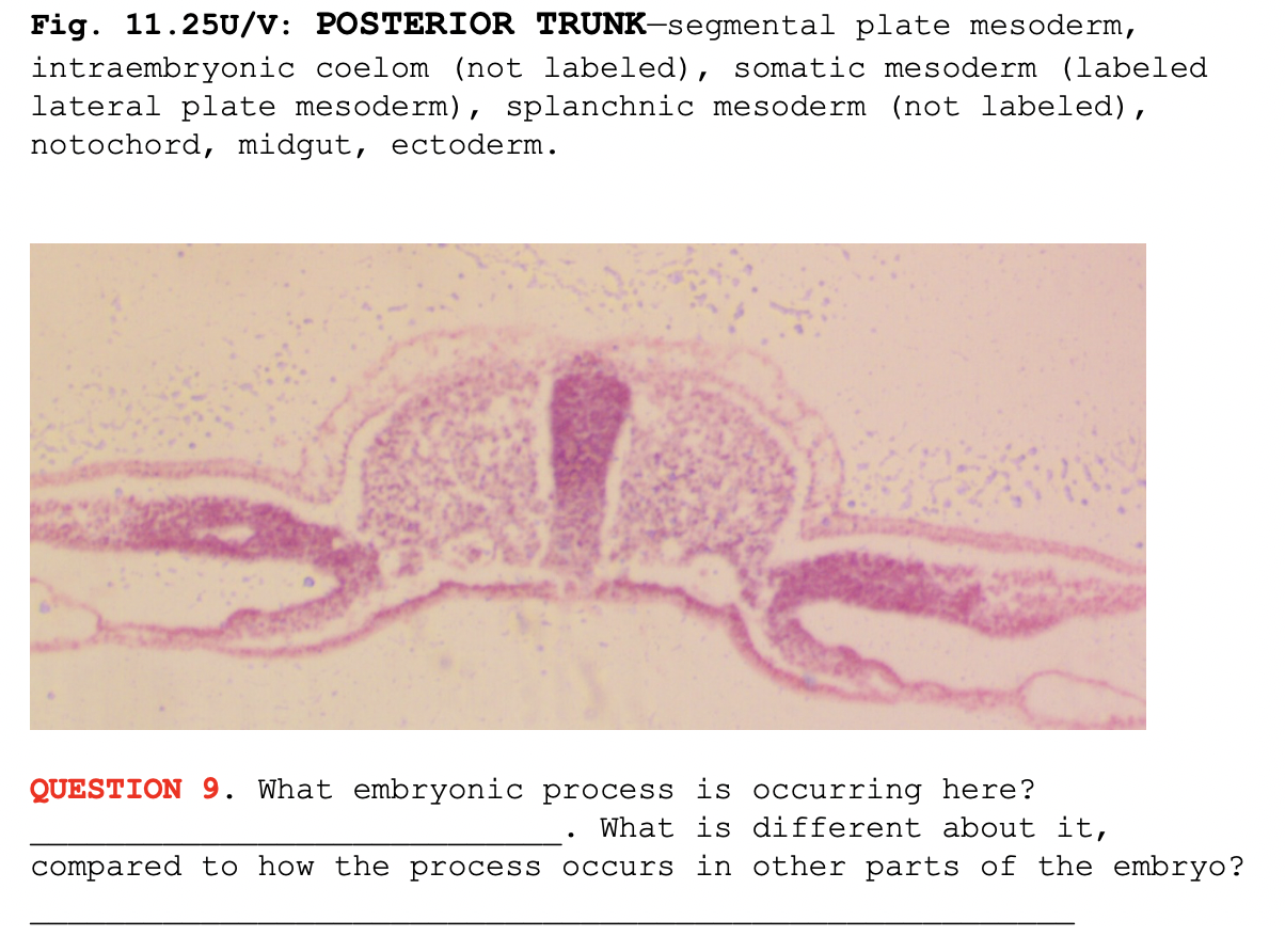 Solved Fig. 11.250/V: POSTERIOR TRUNK-segmental plate | Chegg.com