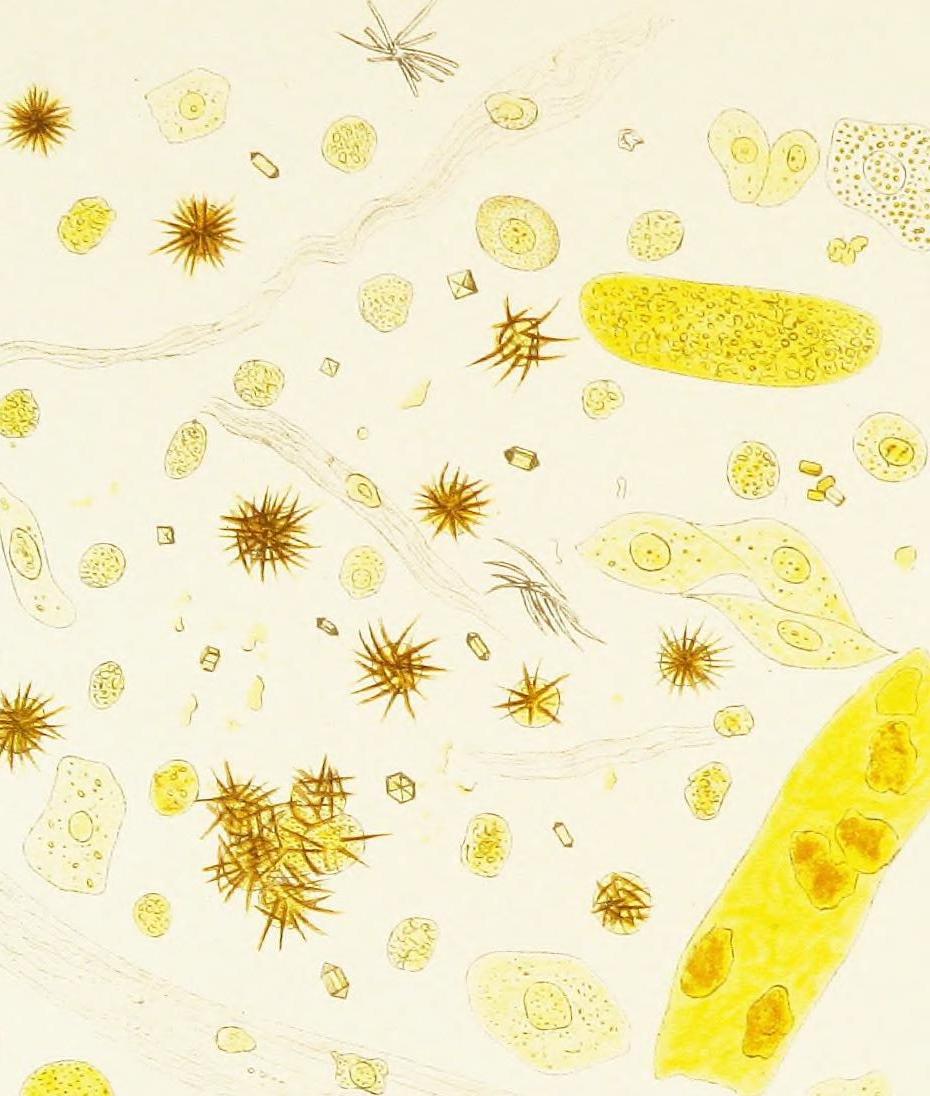 On the image below circle the types of pollen you see | Chegg.com