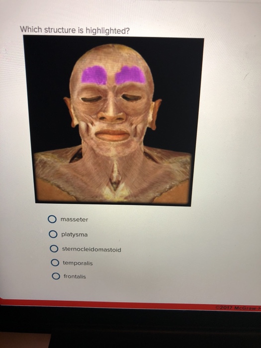 Solved Which structure is highlighted? masseter O platysma O | Chegg.com