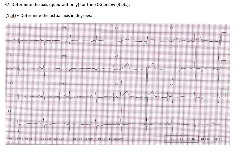 Solved 37 Determine The Axis Quadrant Only For The Ecg