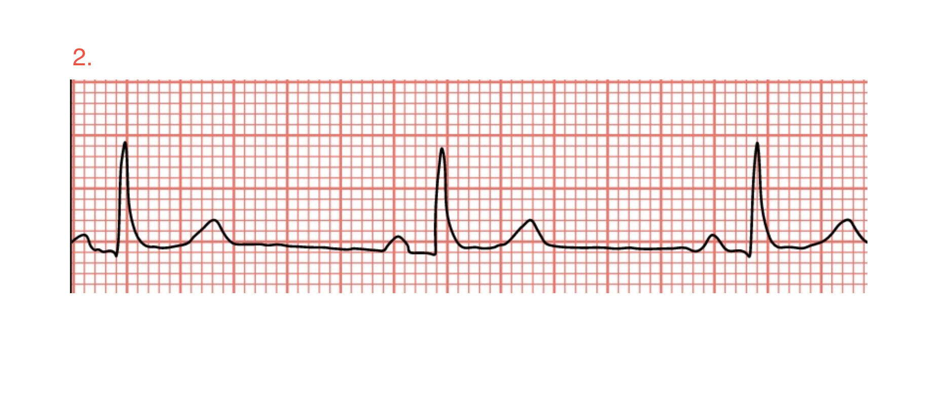 Solved Please find Heart Rate and Rhythm (regular/irregular) | Chegg.com