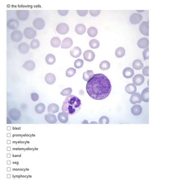 Metamyelocyte Vs Monocyte