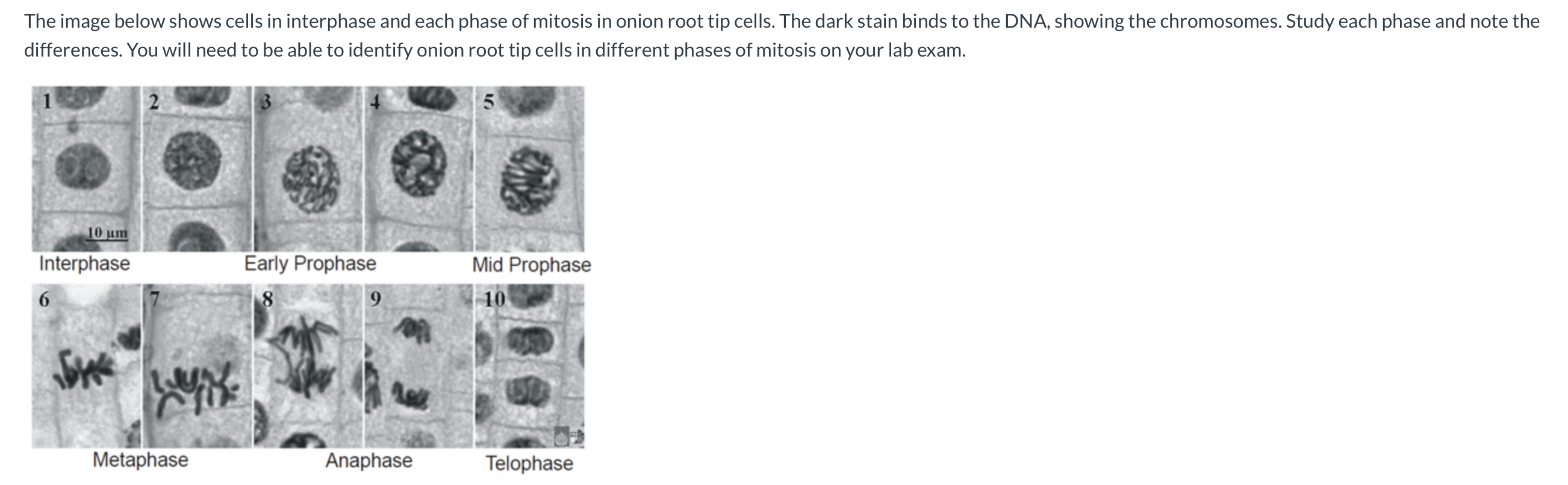Solved Match The Onion Root Tip Cells From The Mitosis Vi Chegg Solved Match The Onion Root Tip Cells From The Mitosis Vi Chegg