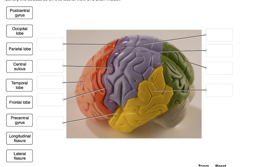 Solved Identify the structures on this anterior-lateral view | Chegg.com