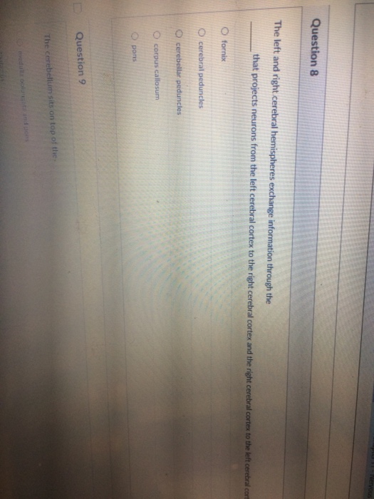 Solved Nervous system questions | Chegg.com