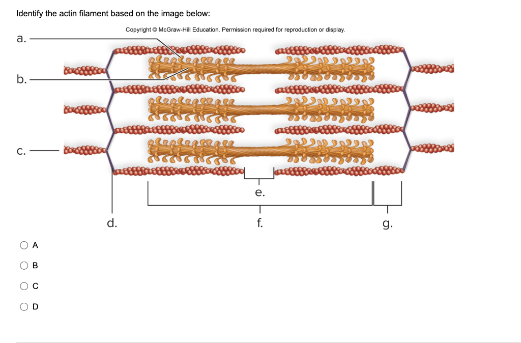 Solved Identify the actin filament based on the image below: | Chegg.com