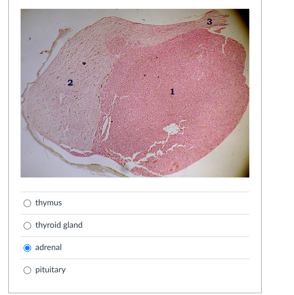 Solved Identify the endocrine gland shown in this gross and | Chegg.com