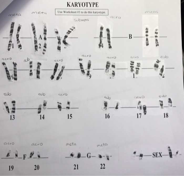 Solved 3. (a) Construct a karyotype(see back of this page) | Chegg.com
