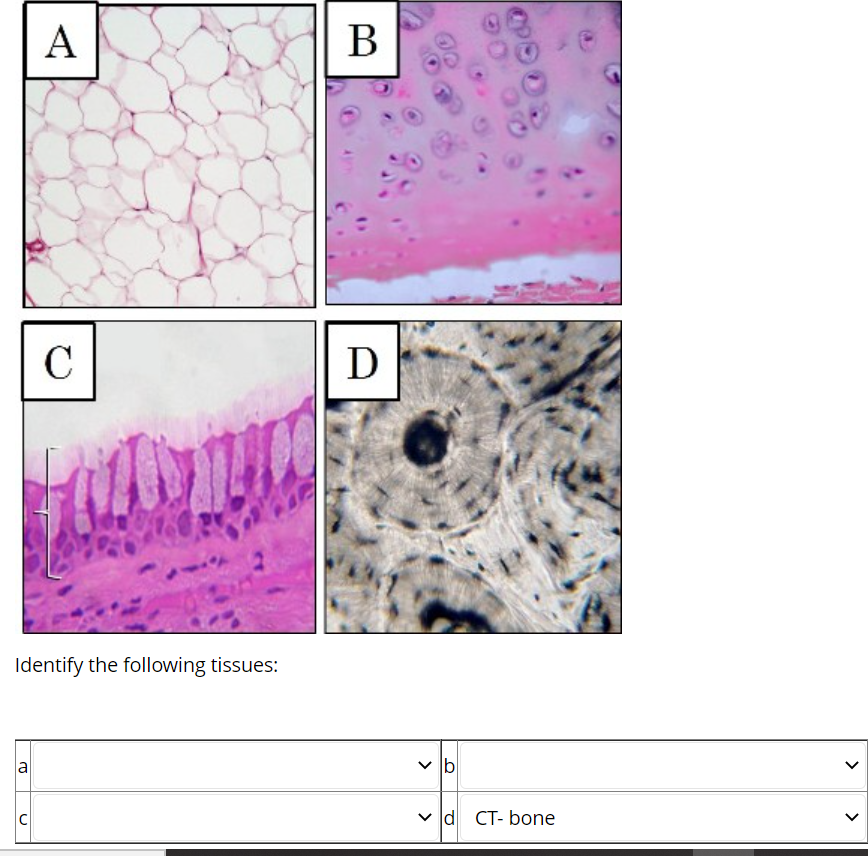 Solved A в B. c D Identify the following tissues: а b C vd | Chegg.com