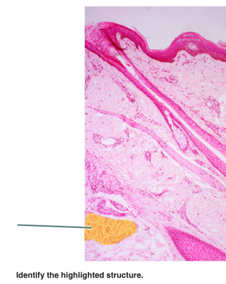 Solved Identify the highlighted structure. | Chegg.com