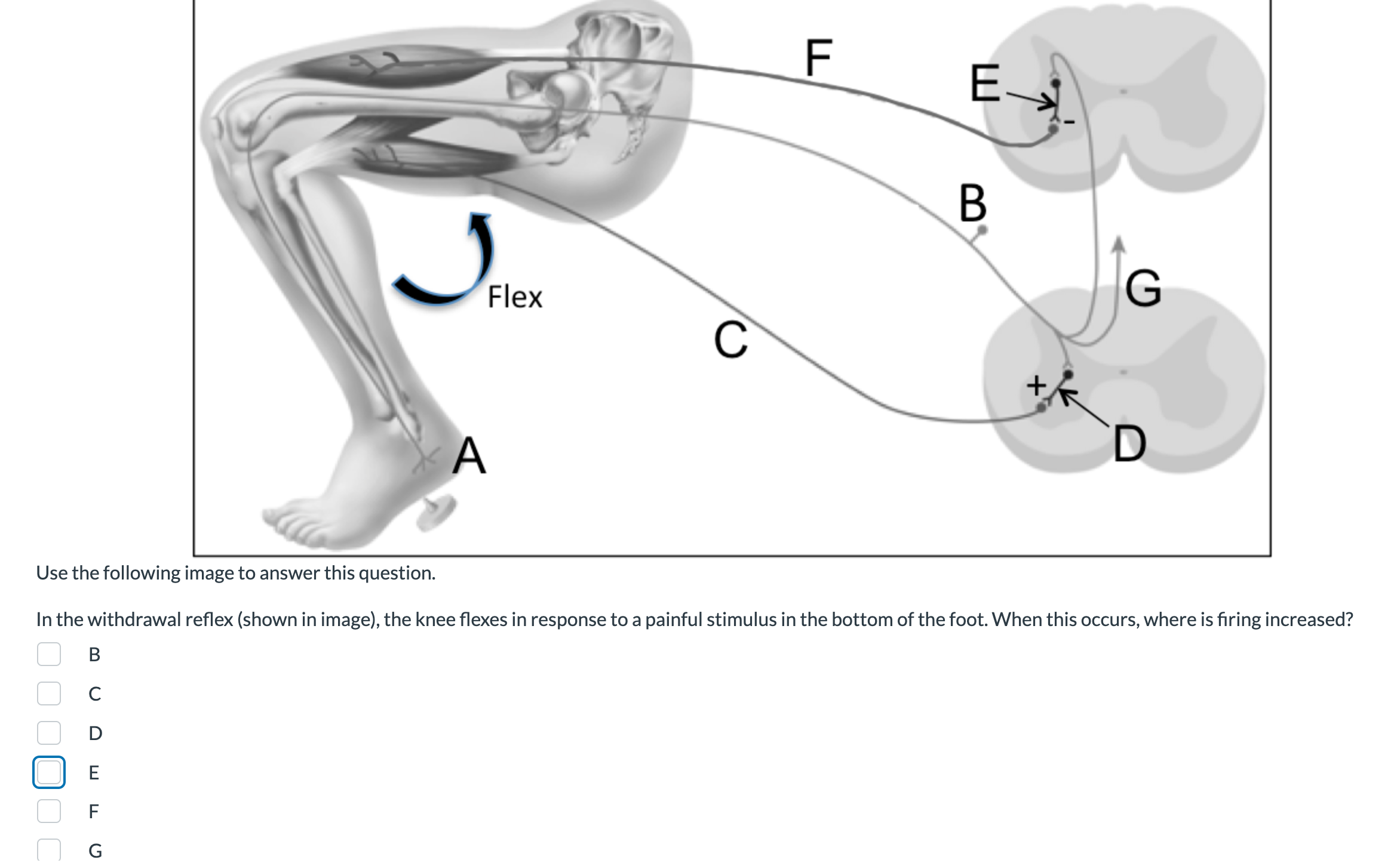 Solved In the withdrawal reflex (shown in image), the knee | Chegg.com