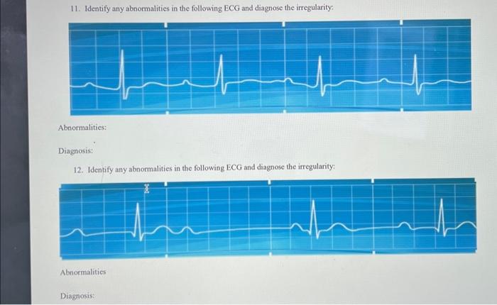 Solved Identify any abnormalities in the following ECG and | Chegg.com