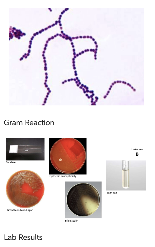 Solved Gram Reaction Lab Results | Chegg.com