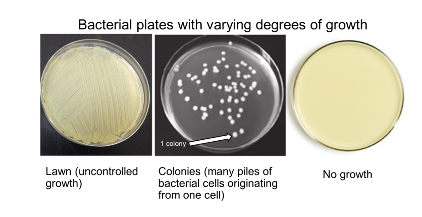 Solved Bacterial plates with varying degrees of growth 1 | Chegg.com