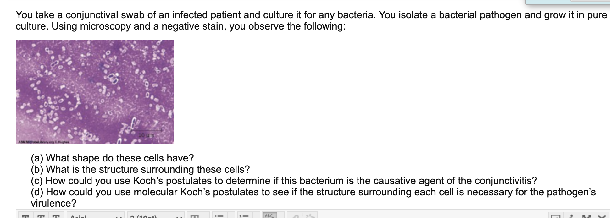 You take a conjunctival swab of an infected patient | Chegg.com