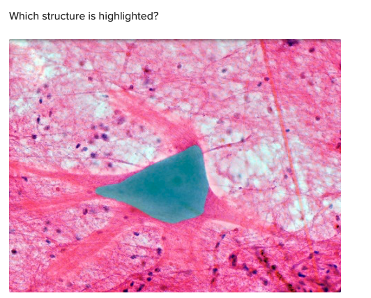 Solved Multiple Choice axon collateral soma of | Chegg.com