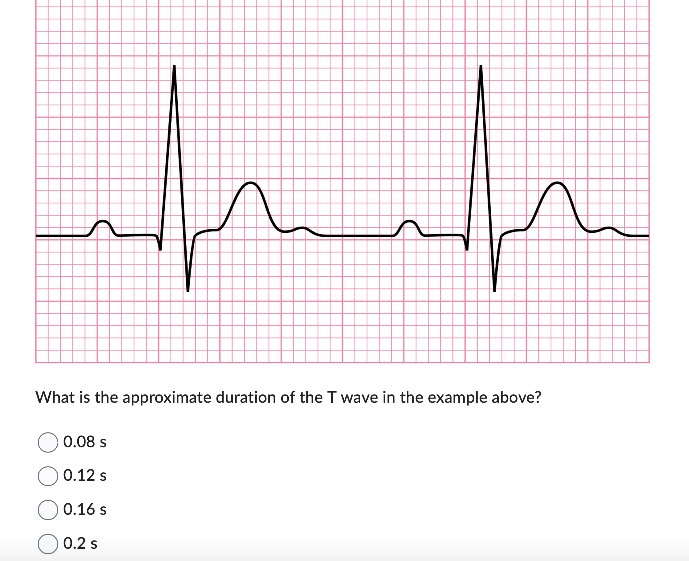 Solved What is the approximate duration of the T wave in the | Chegg.com