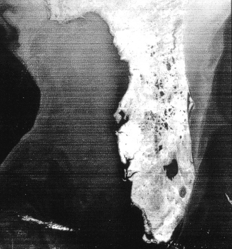 Using the matlab Compare the notch filter and optimum | Chegg.com