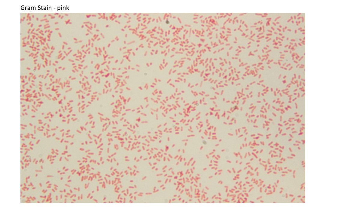 Solved TSA Appearance of colonies Color of colonies | Chegg.com