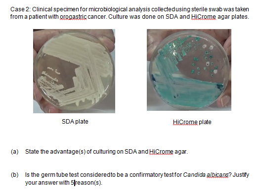 Solved Case 2: Clinical specimen for microbiological | Chegg.com