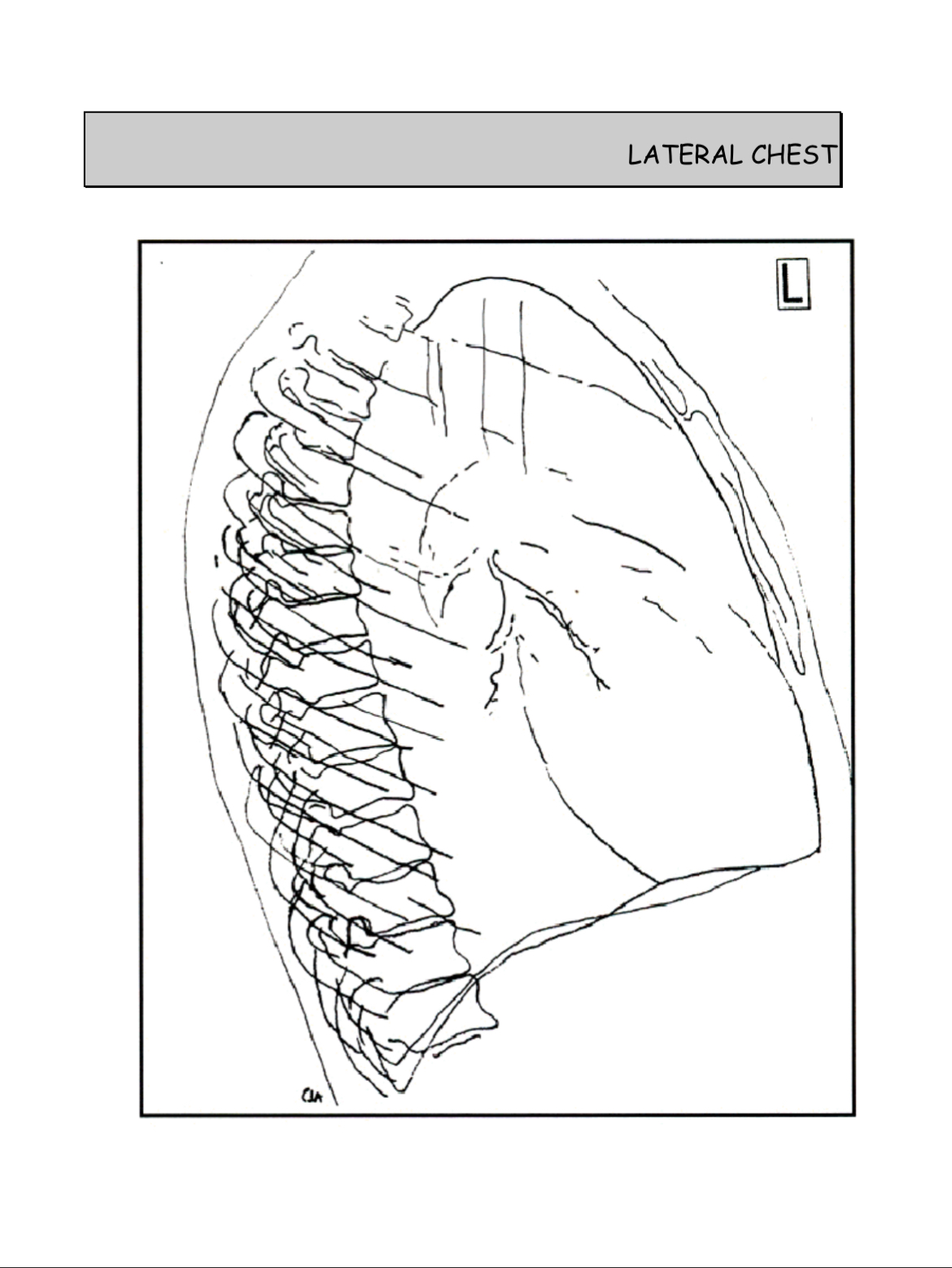 Solved Lateral chest - , ﻿outline the heart; label the | Chegg.com