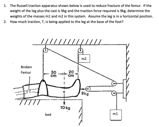 Solved 1. The Russell traction apparatus shown below is used | Chegg.com