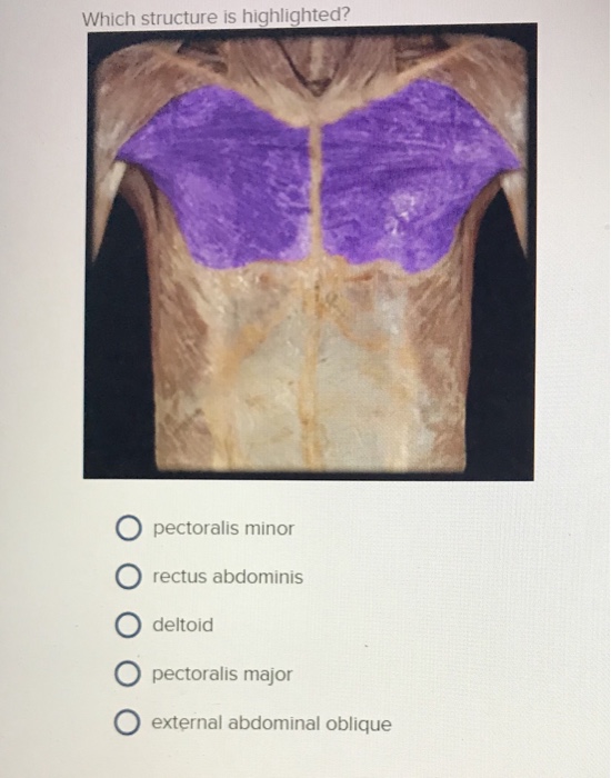 Solved Which structure is highlighted? O triceps brachil O | Chegg.com
