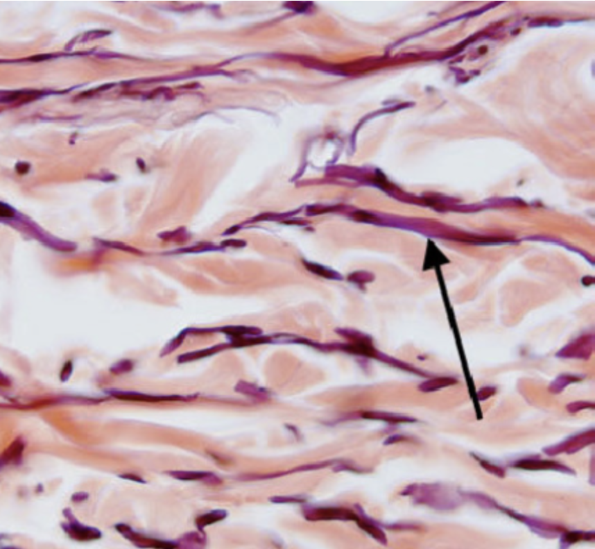 Solved Determine the type of connective tissue (black arrow) | Chegg.com