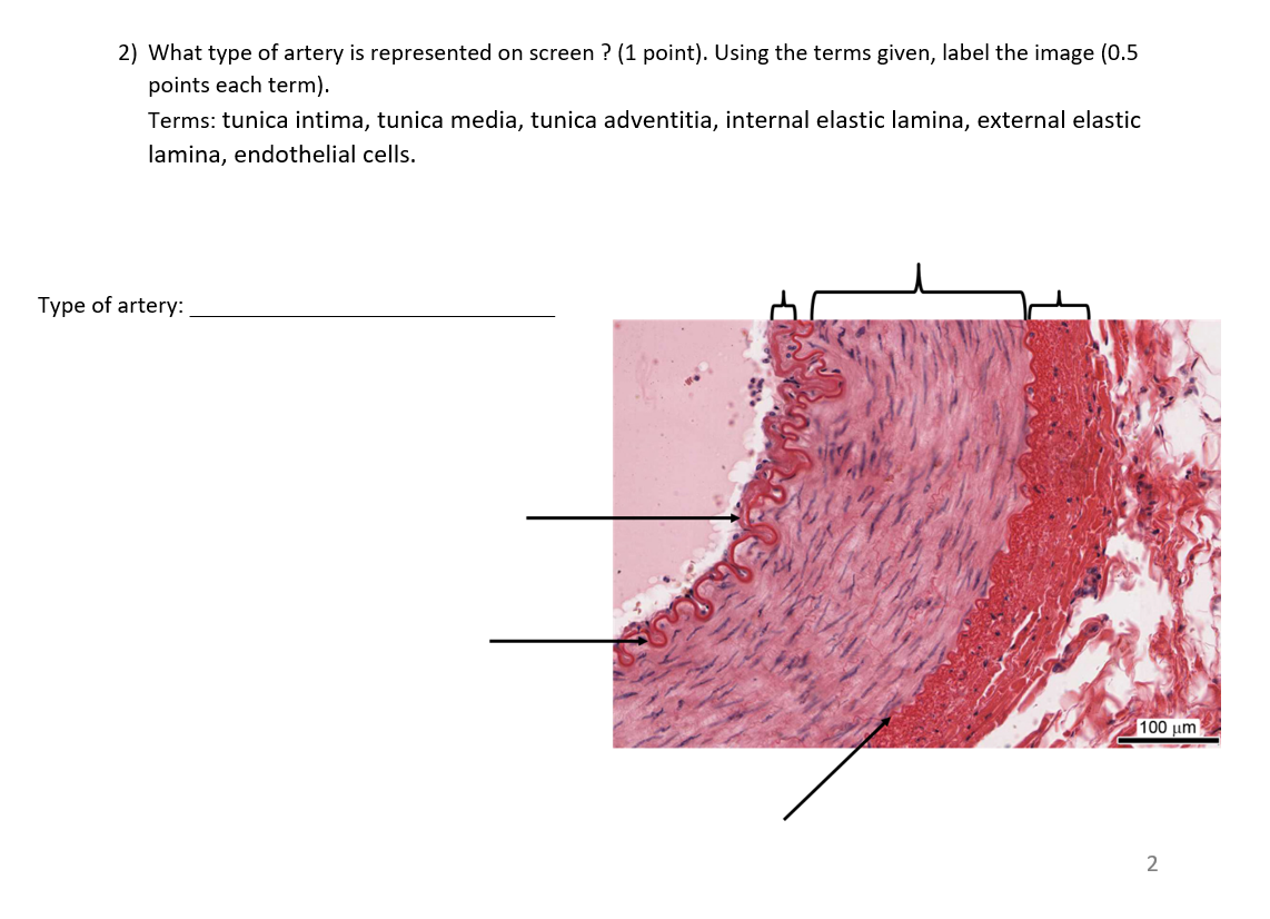 Elastic Artery Histology