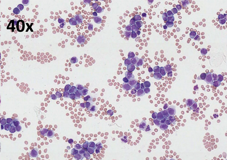 Solved identify blood smear | Chegg.com