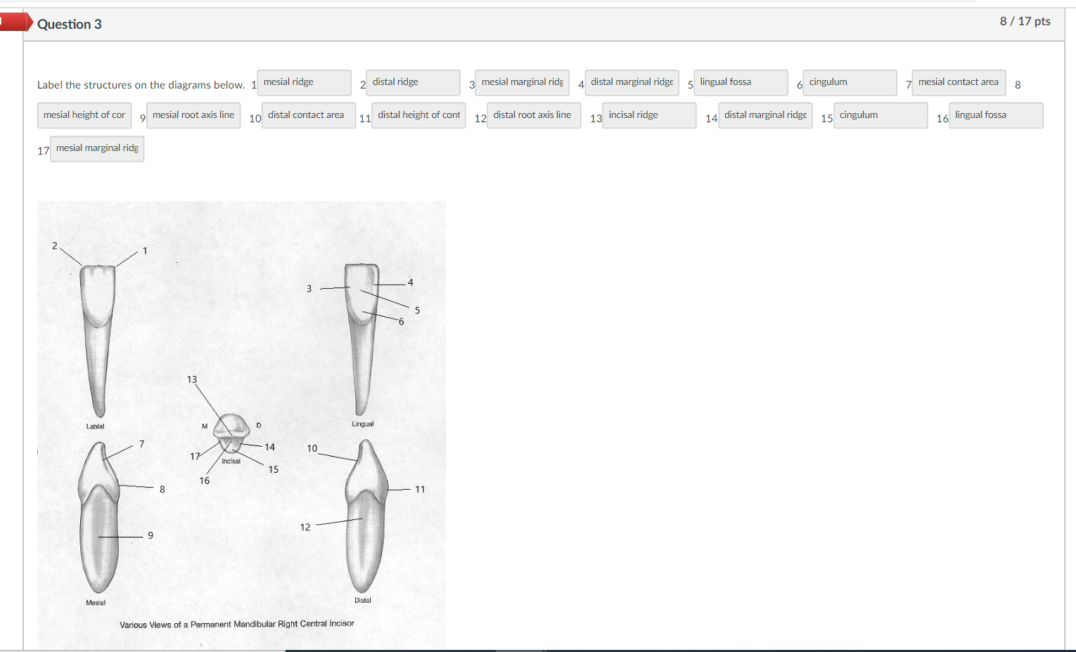 Solved Question 3 Various Views of a Permanent Mandibular | Chegg.com