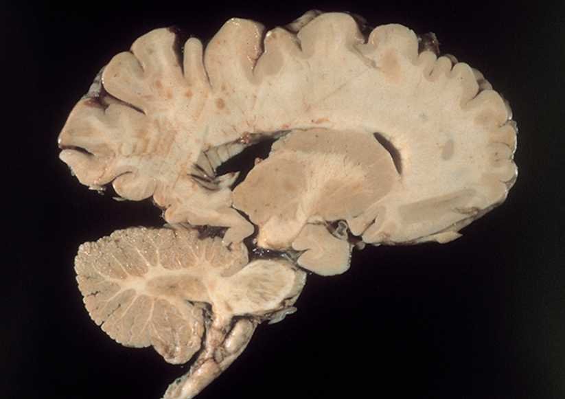 Solved Please label with numbers:Caudate | Chegg.com