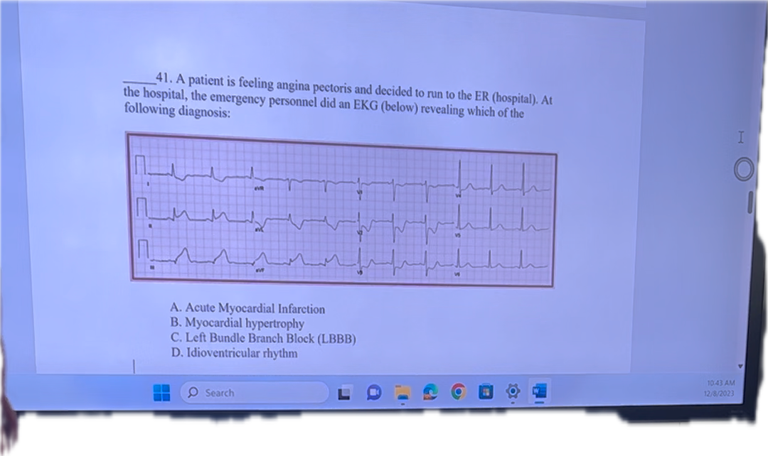 Solved Cardio Review 1. Cardiac cycle runs in systole and | Chegg.com