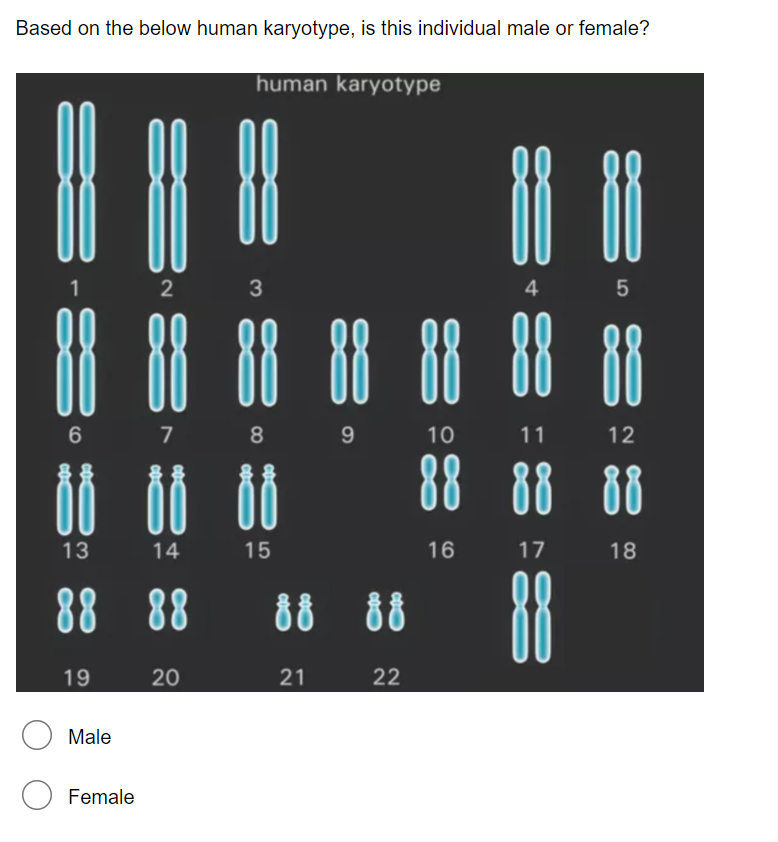 Solved Based on the below human karyotype, is this | Chegg.com